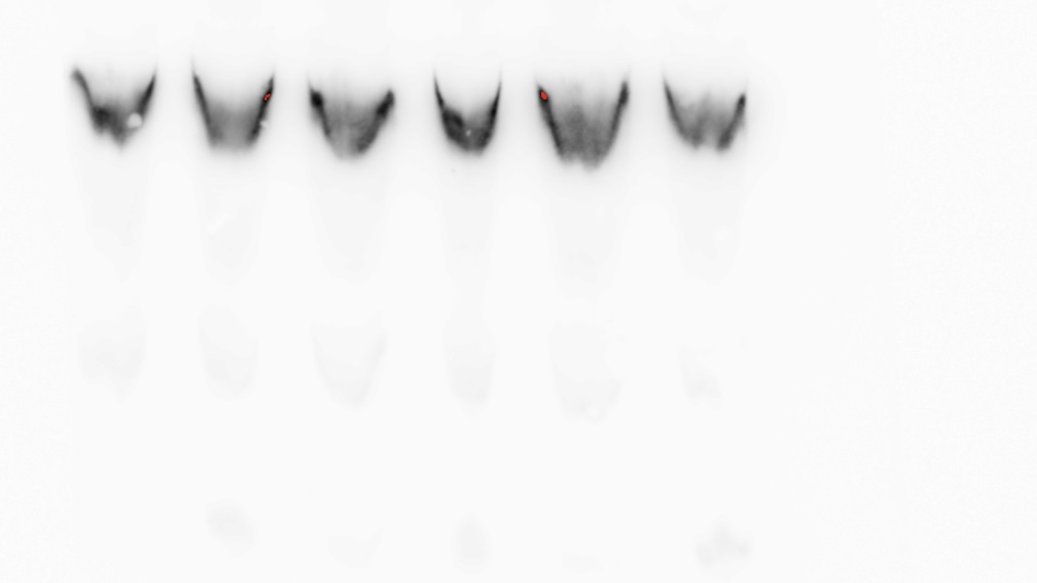 The 8 Western Blot Failures and How to Prevent Them (2025 Guide)