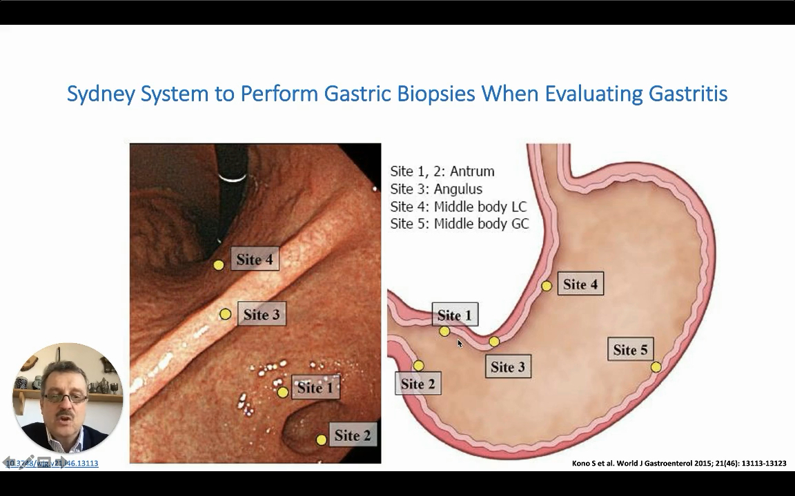 Sydney Protocol for Stomach Biopsies