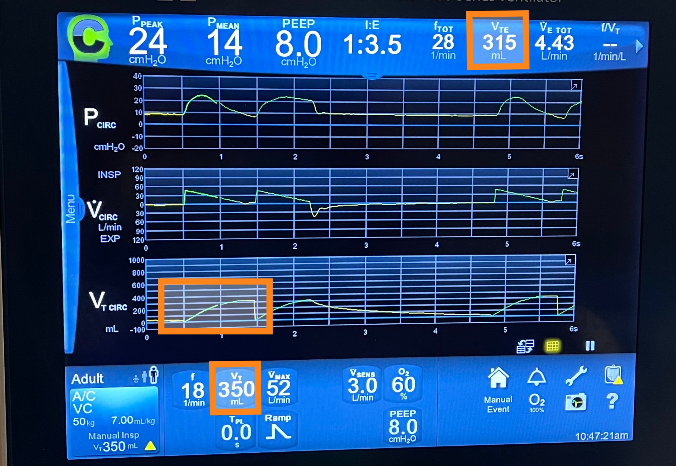Mechanical Ventilation Made Simple: 9 Concepts Every Non-ICU Doc Should ...