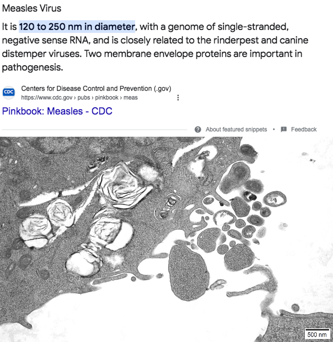 The Truth About Contagion, Viruses & Germ Theory - Part 2