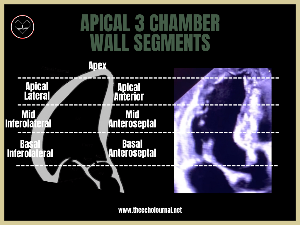 Apical 2 and 3: Acquisition, Angles, and Accuracy