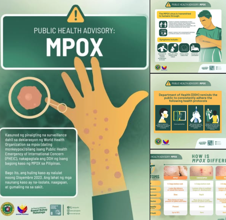 Philippines: 1st mpox case reported in Zamboanga Sibugay, Rise reported ...