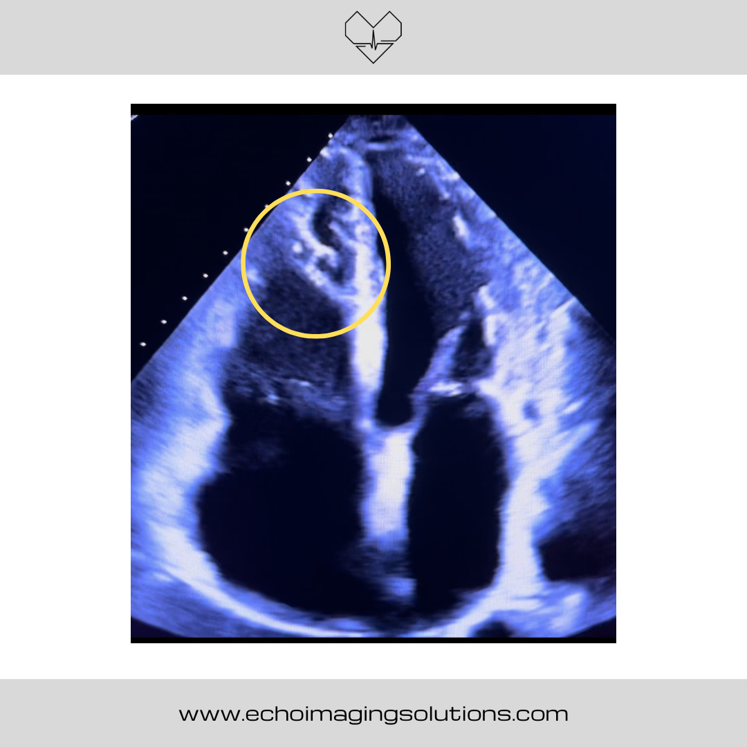 What is the Moderator Band? - The Echo Journal