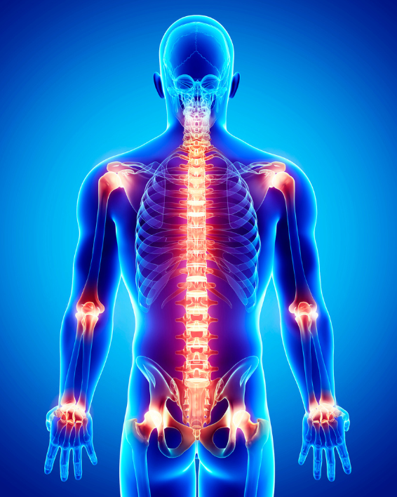 SOD1, SOD2, and SOD3 Genes: Unlocking the Link to Arthritis