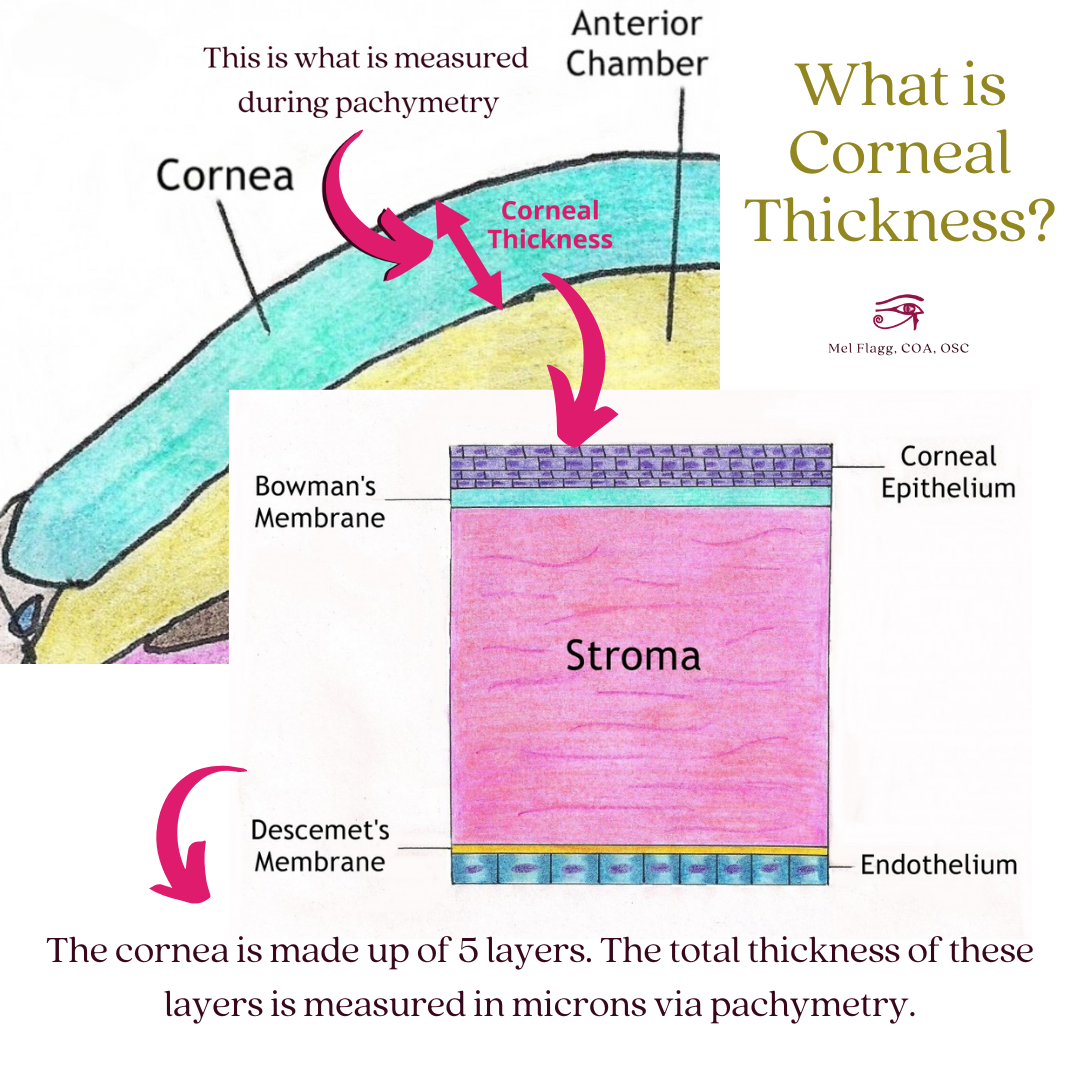 Narrow Angle Glaucoma: Causes, Symptoms, and Treatments