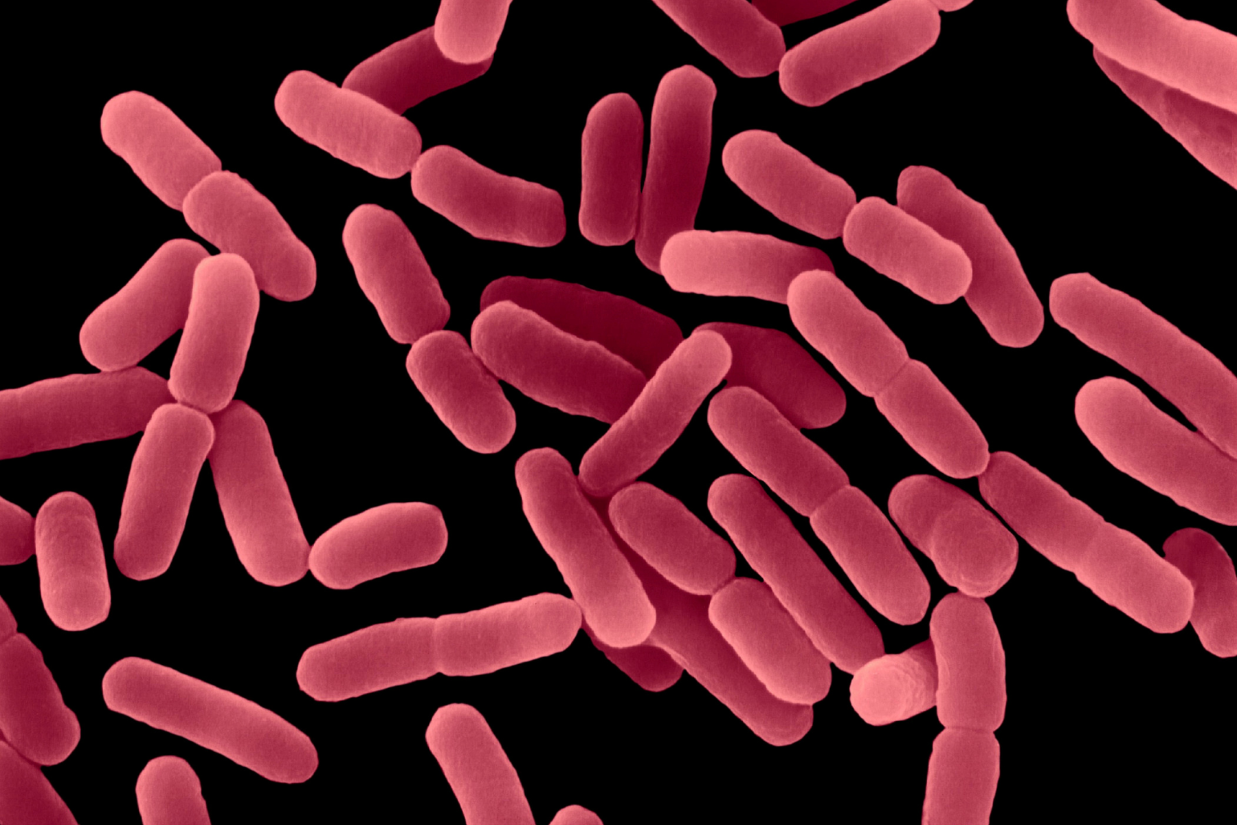 What Are Superbugs in Microbiology? - by Shekhar