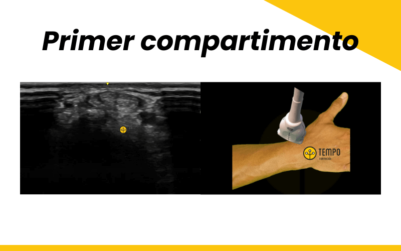 Compartimentos extensores de la muñeca - by Tempo Formación