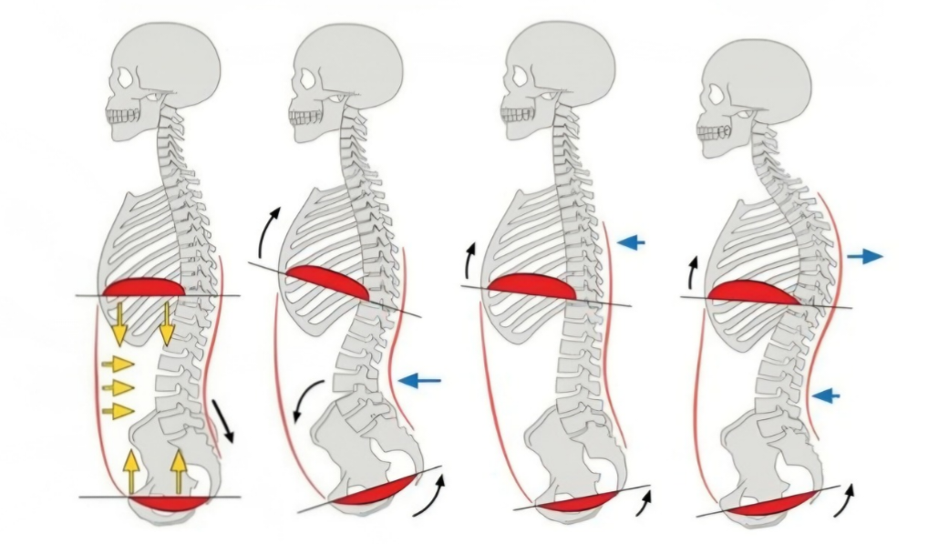 The Pelvis in Motion: How Gait, Slings & Pelvic Control Shape ...