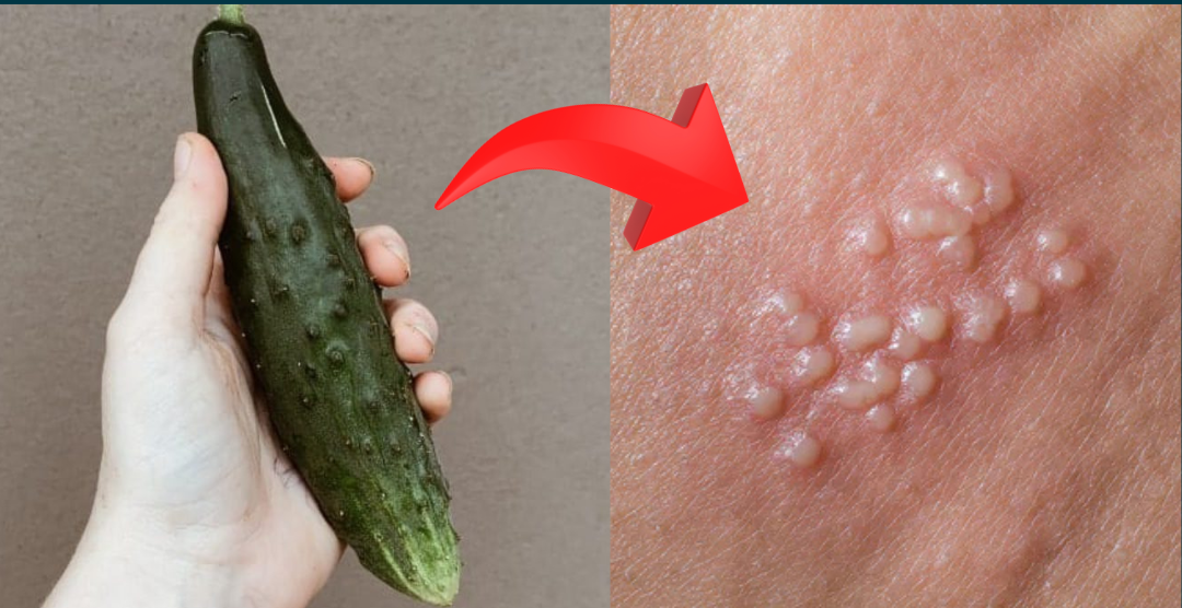 Bolhas ou bolinhas no pênis: 5 causas (e o que fazer)