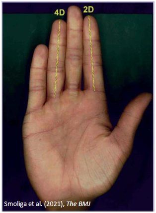 Finger Length and Health Risks - by Dr. Ken Springer