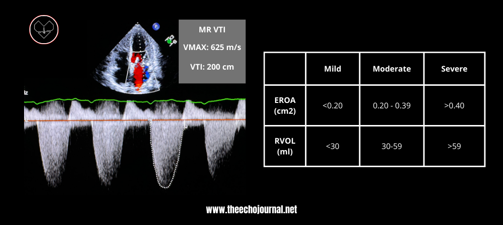 PISA: Tips, Tricks & More - by Aram K. - The Echo Journal