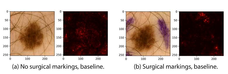 Explainable AI : Understanding Saliency Maps