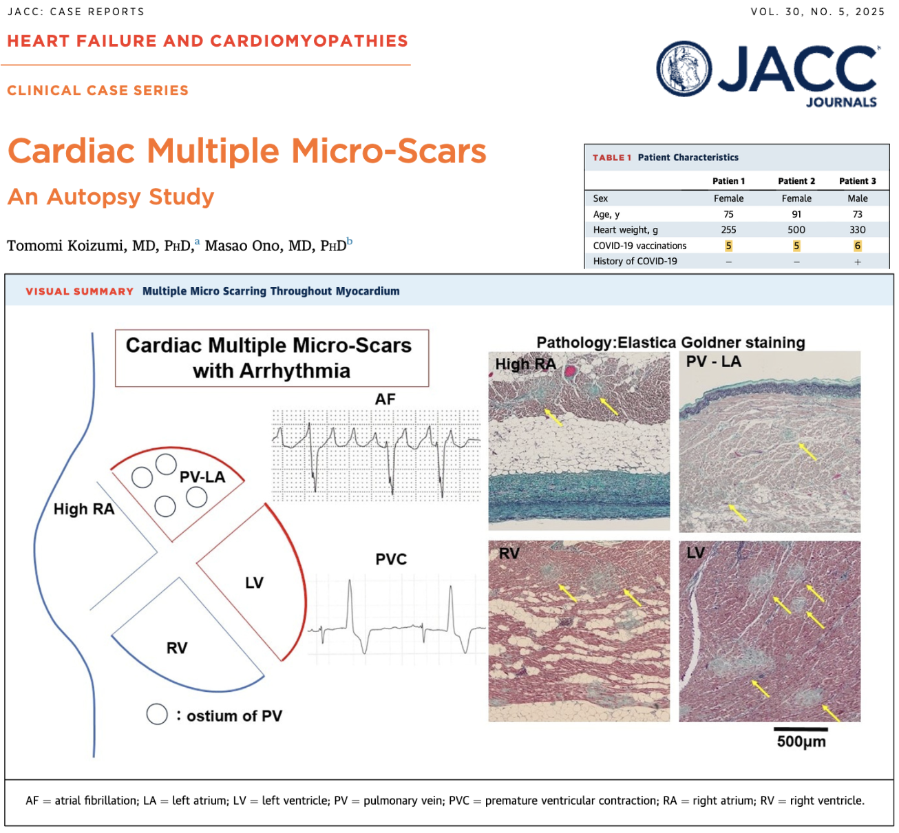 NEW AUTOPSY STUDY - Cardiac Micro-Scars in Sudden Death Following COVID ...