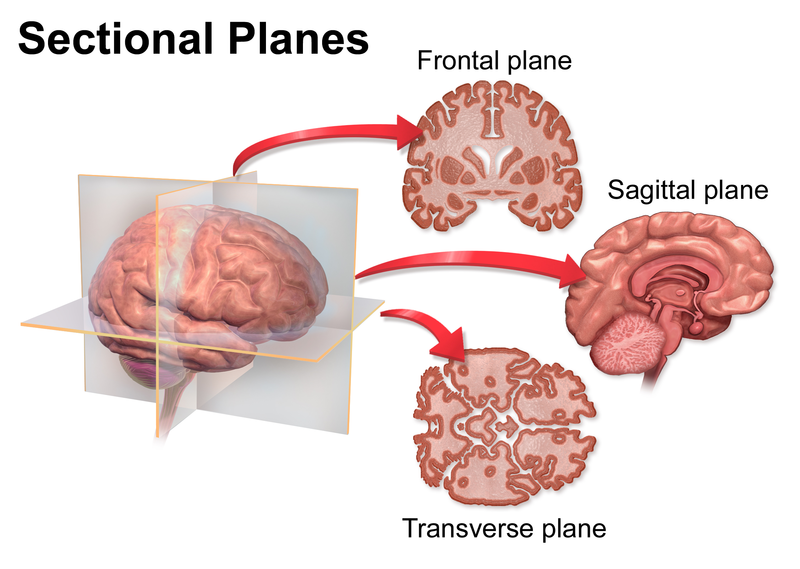 A Journey Through Neuroanatomy: Navigating the Brain