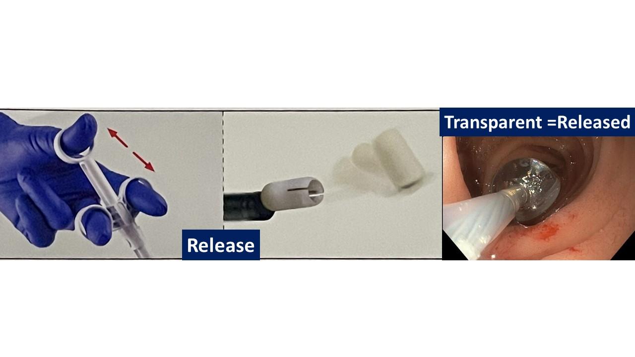 How to Deploy a Capsule Endoscope During EGD