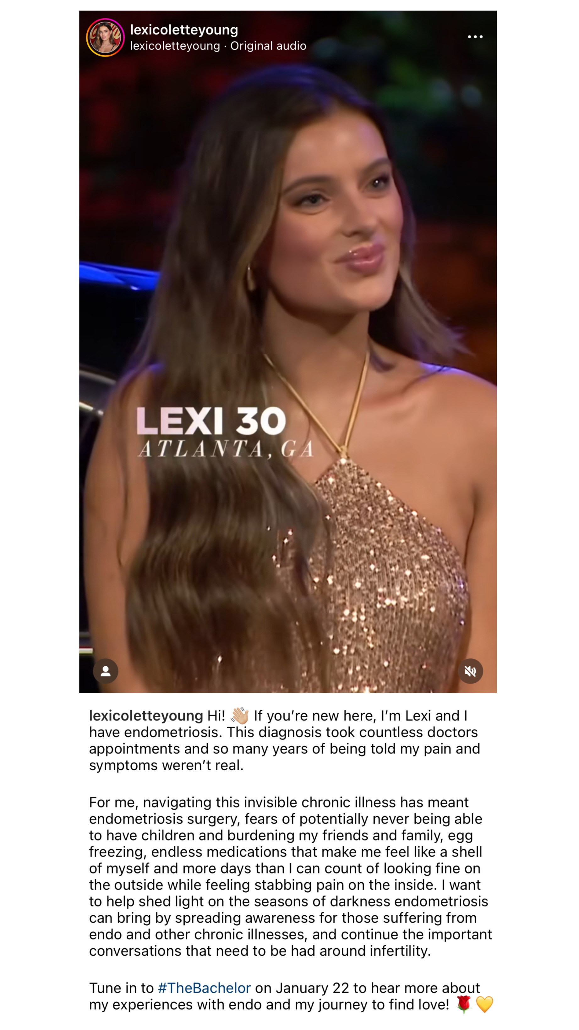 The Bachelor's Lexi Young - by Meghan Lorine