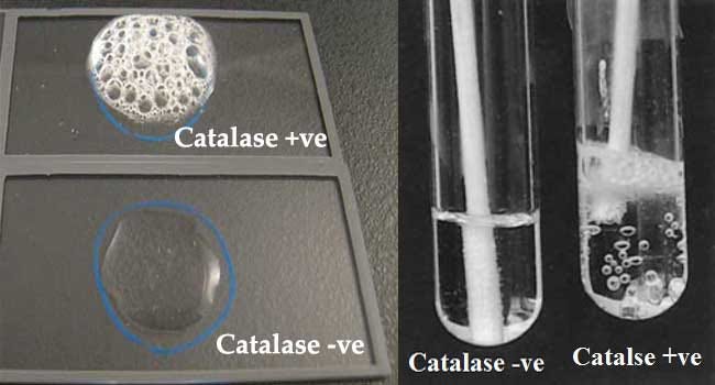 Catalase Test- Principle, Procedure, and Result Interpretation.