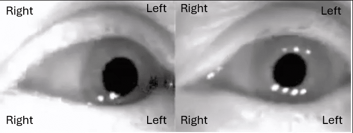 The Saccade Explained: Decoding the Eye Movements You See at the Bedside