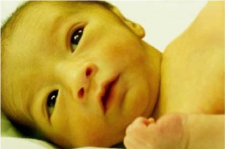 Pediatric Pearls: Infant's Skin Part 1 - Color Variations