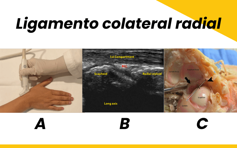 Ligamento colateral radial y ligamento colateral cubital