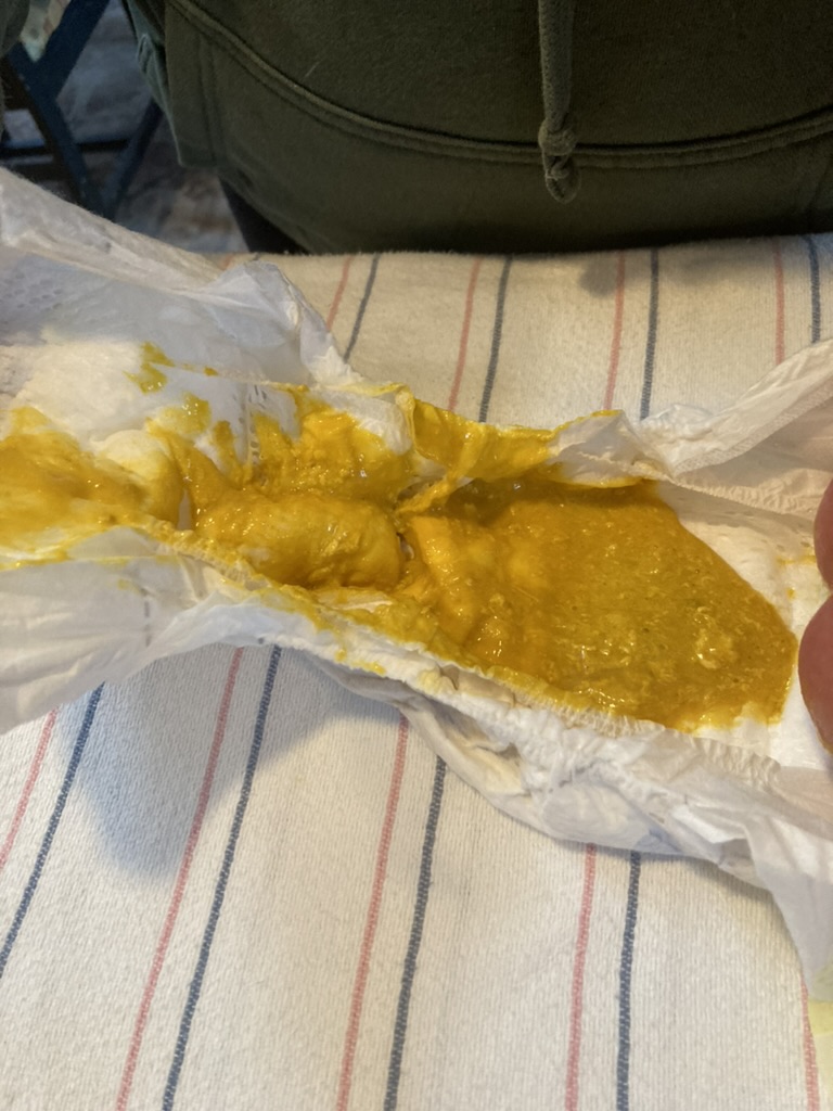 What’s the diagnosis? 4 things to think of when the newborn hasn’t pooped