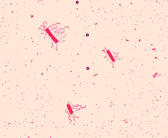 A Visual Journey through Bacterial Morphology: Understanding Microbial ...