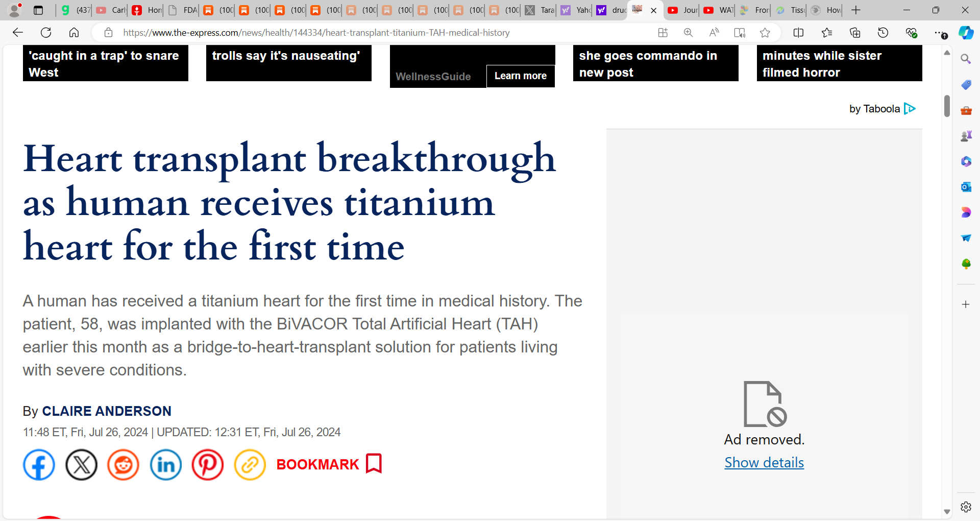 Human titanium heart: Heart transplant breakthrough as human receives ...