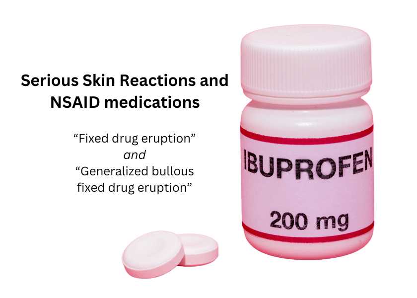 Skin Reactions and NSAIDs: Arthrotec, Celebrex, Daypro, Naprosyn ...