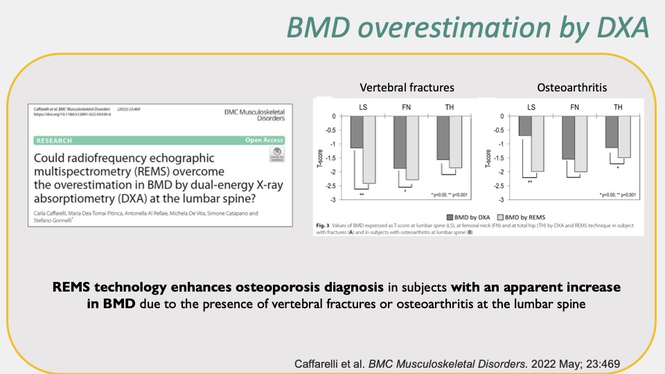 R.E.M.S. - by A Midwest Doctor