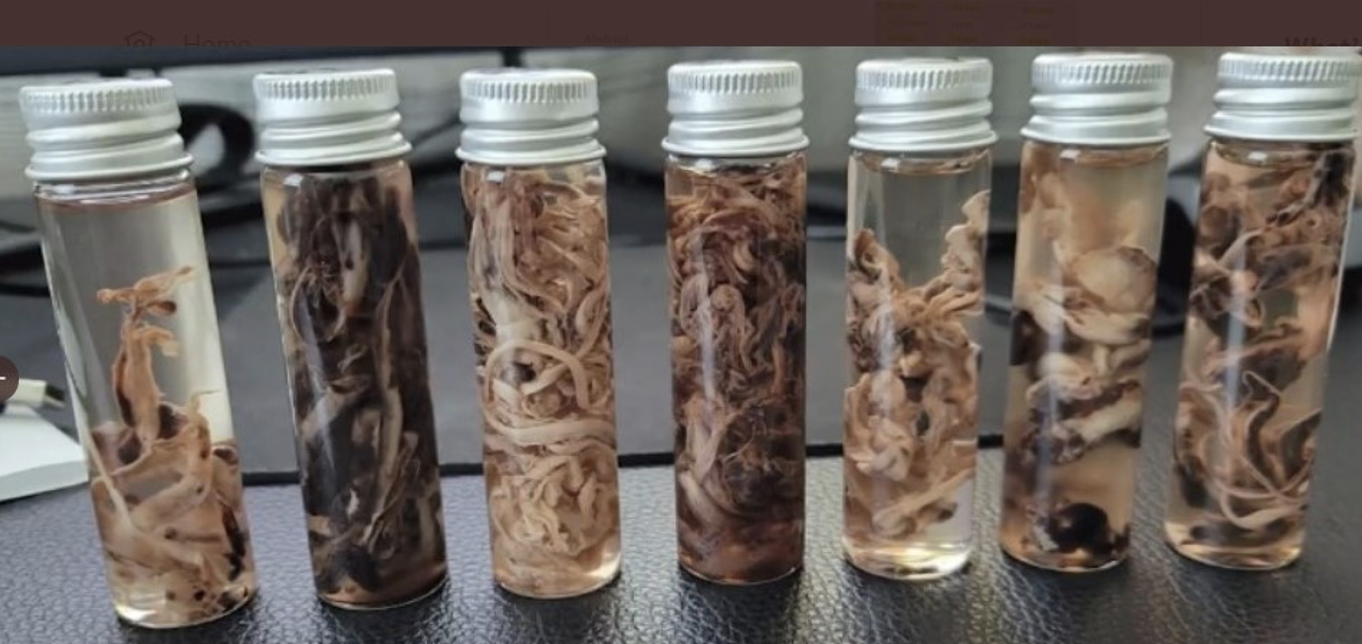Microscopic and Biochemical Analysis of Anomalous White Fibrous Clots ...