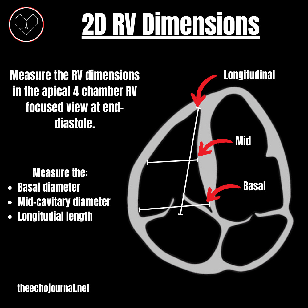 Apical 4 and 5: Technique, Landmarks, and Optimization