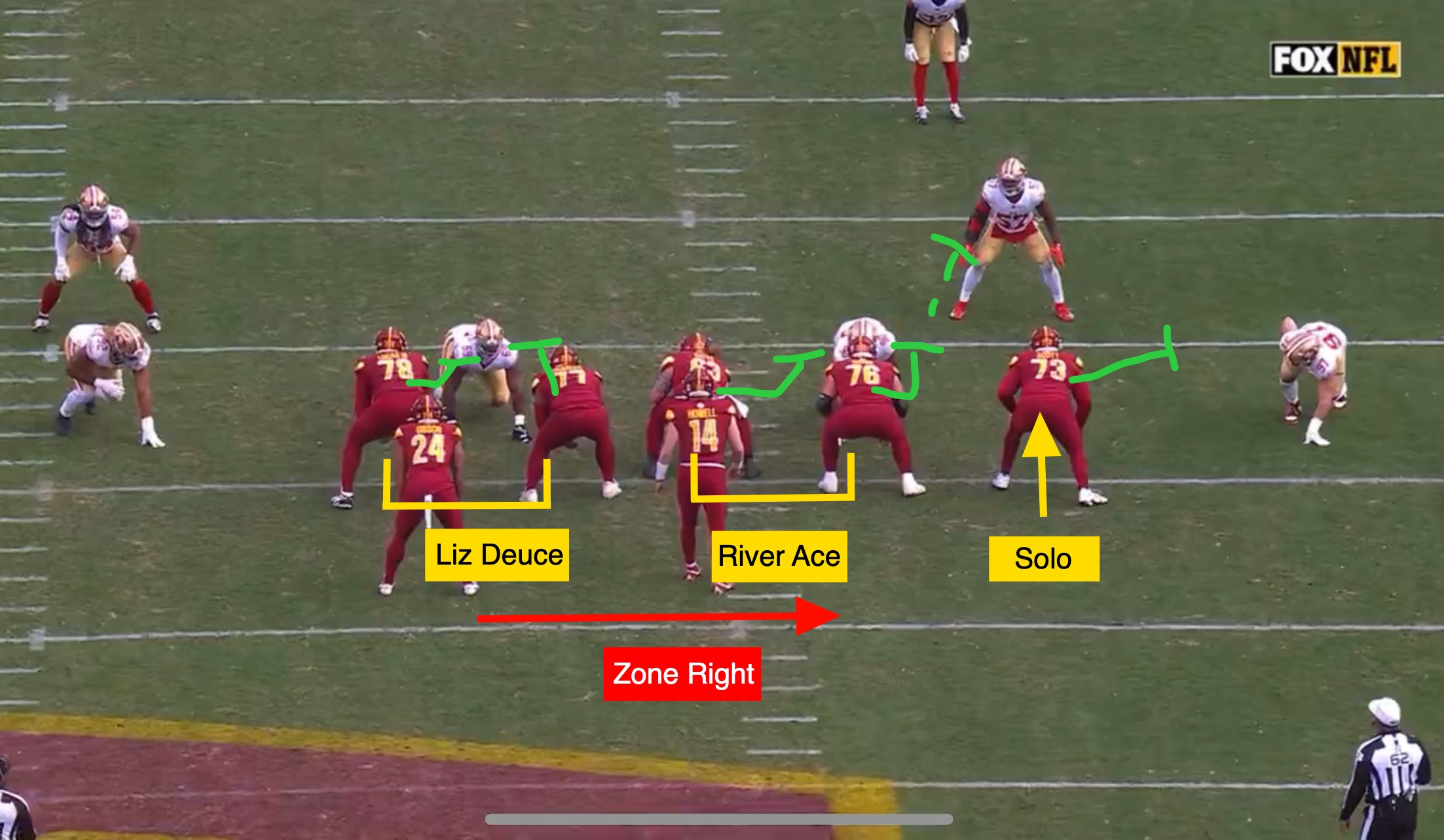 Zone Combo Blocks - by Matt Saunders