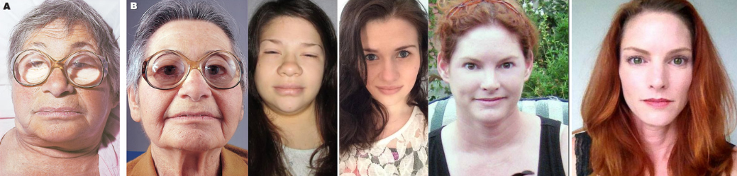 Thyroid Supplementation Simplified - T3Uncoupled’s Substack