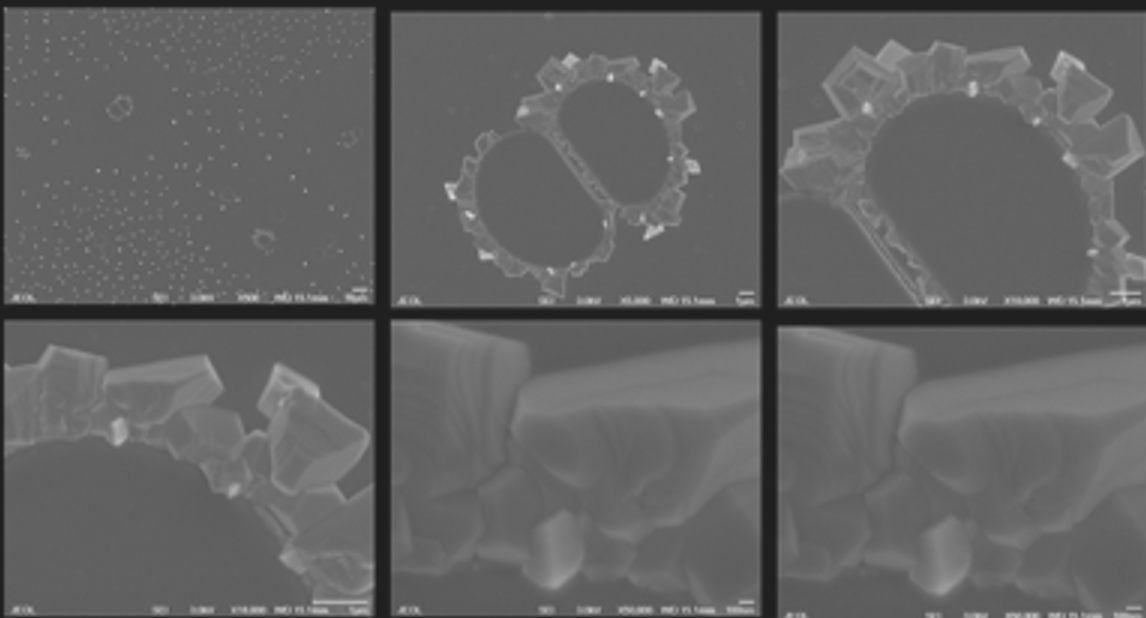 Electron Microscopy Of The Blood Of A 43 Year Old With 3 Pfizer ...