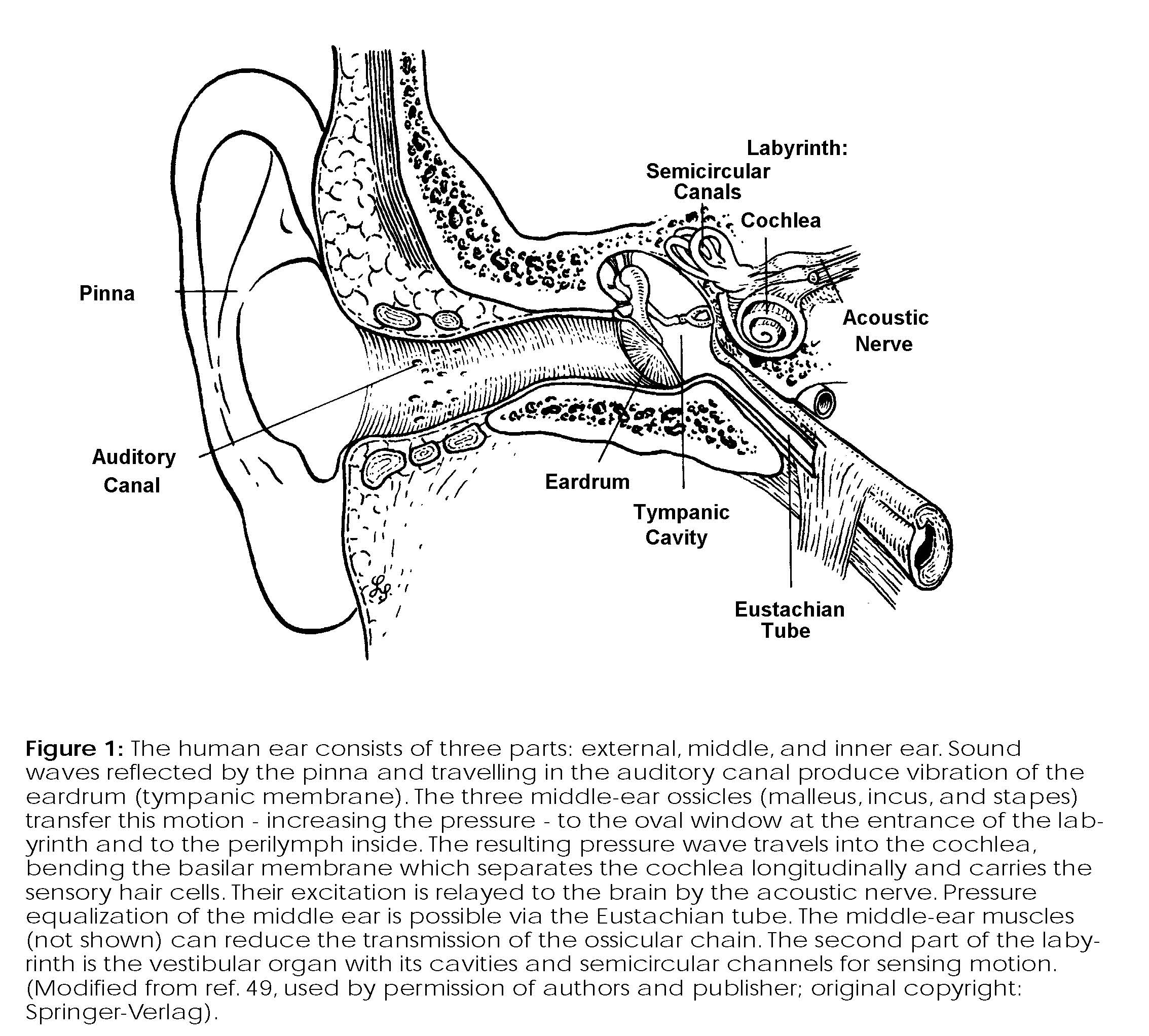 Long Range Acoustic Device (LRDA) [i] - by Mike Mihajlovic
