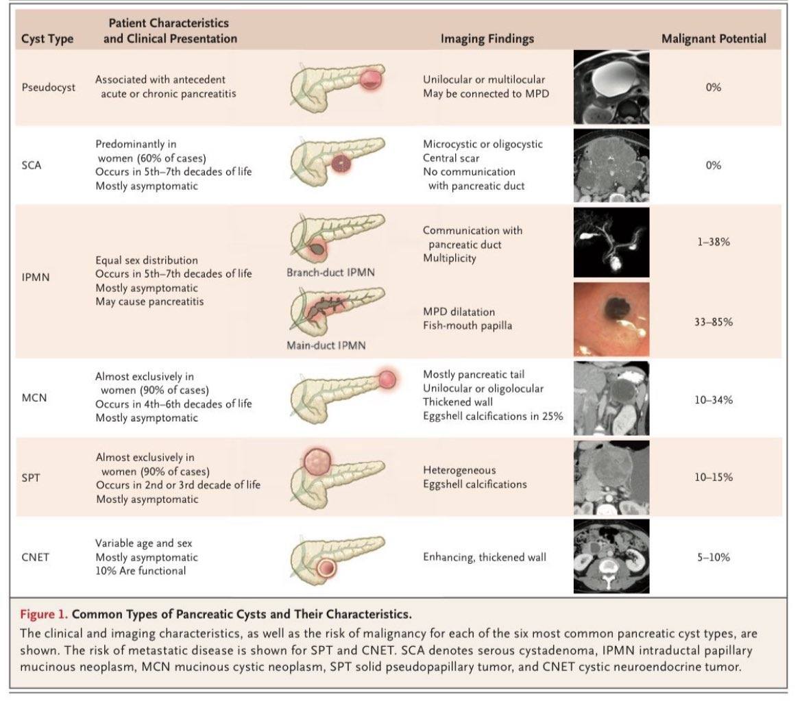 Common Types of Pancreatic Cysts and Their Characteristics