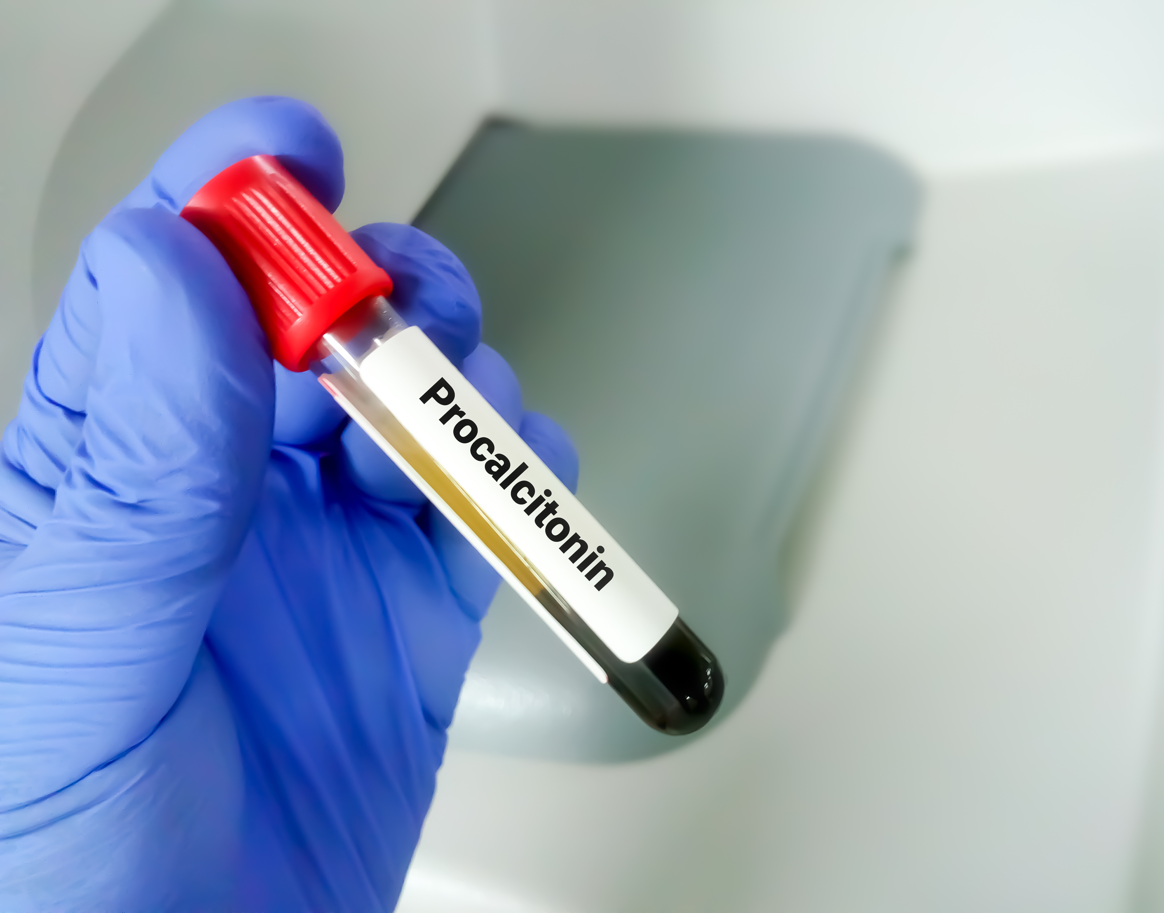 Is procalcitonin "safe" to guide antibiotic use in patients with sepsis?