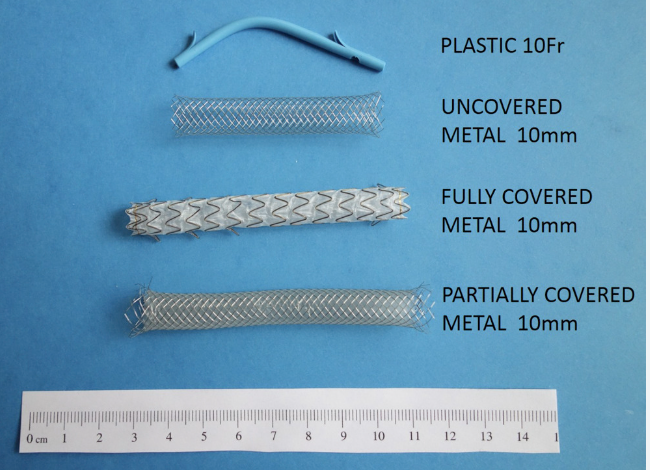 ERCP Explained: Why It's Done and What to Expect