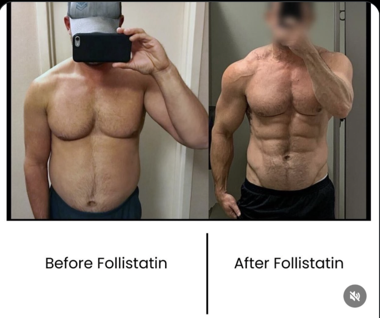 Ready or Not, Gene Therapy is Here - by Abud Bakri MD