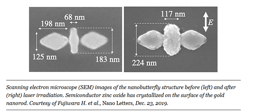 Electron Microscopy Of The Blood Of A 43 Year Old With 3 Pfizer ...