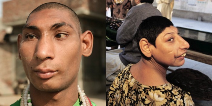 The Shrine of Abandonment: The "Rat Children" of Shah Daulah, Pakistan