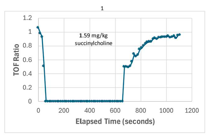 The Myth of Phase 1 and Phase 2 Block From Succinylcholine