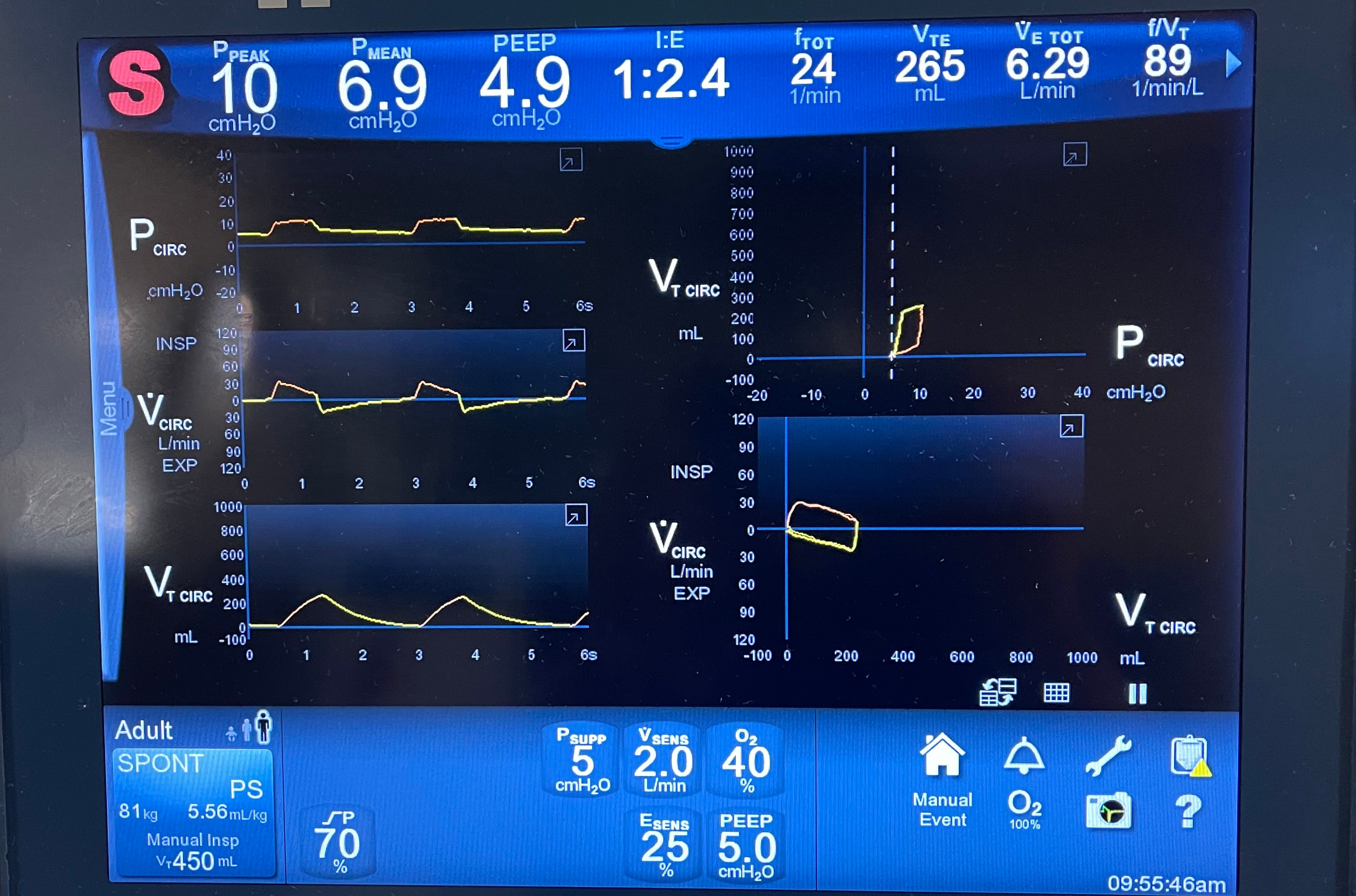 Mechanical Ventilation Made Simple: 9 Concepts Every Non-ICU Doc Should ...