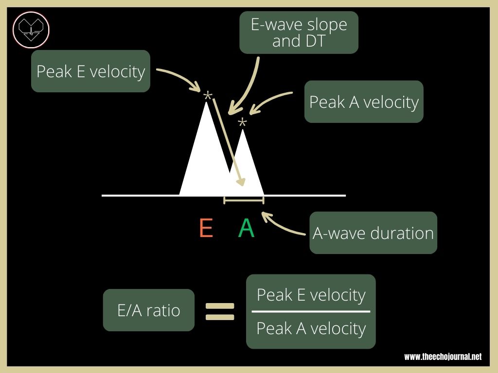 Navigating Diastolic Dysfunction - by Alex C.