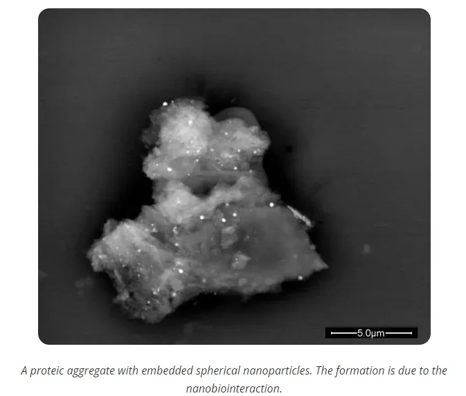 Electron Microscopy Of The Blood Of A 43 Year Old With 3 Pfizer ...