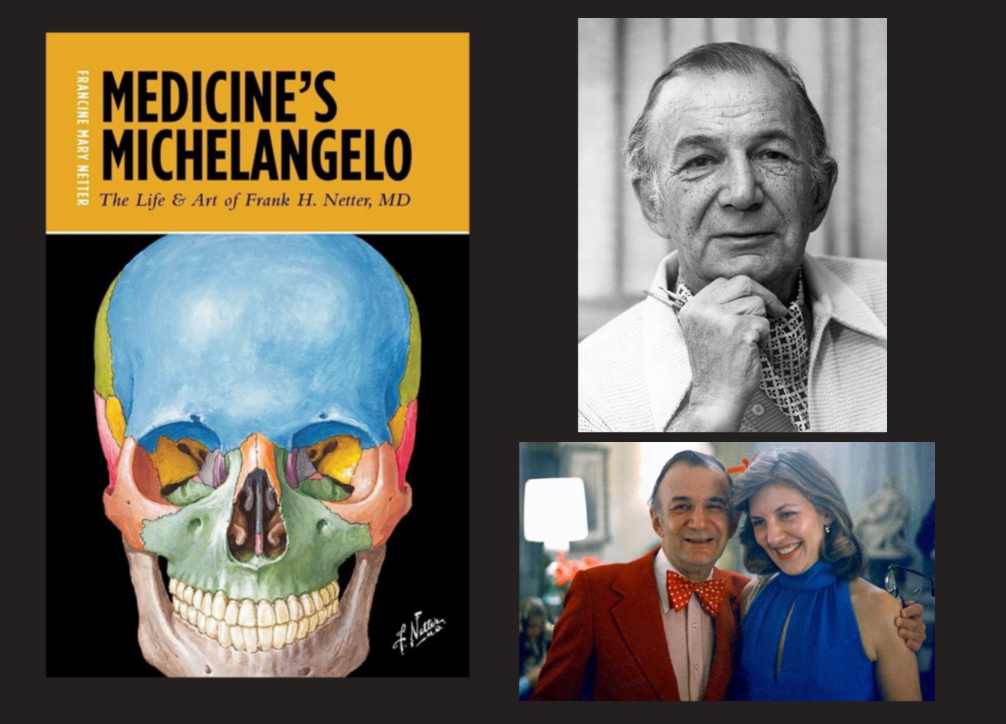 Who was Frank H. Netter, MD? - by Sapana Adhikari, MD