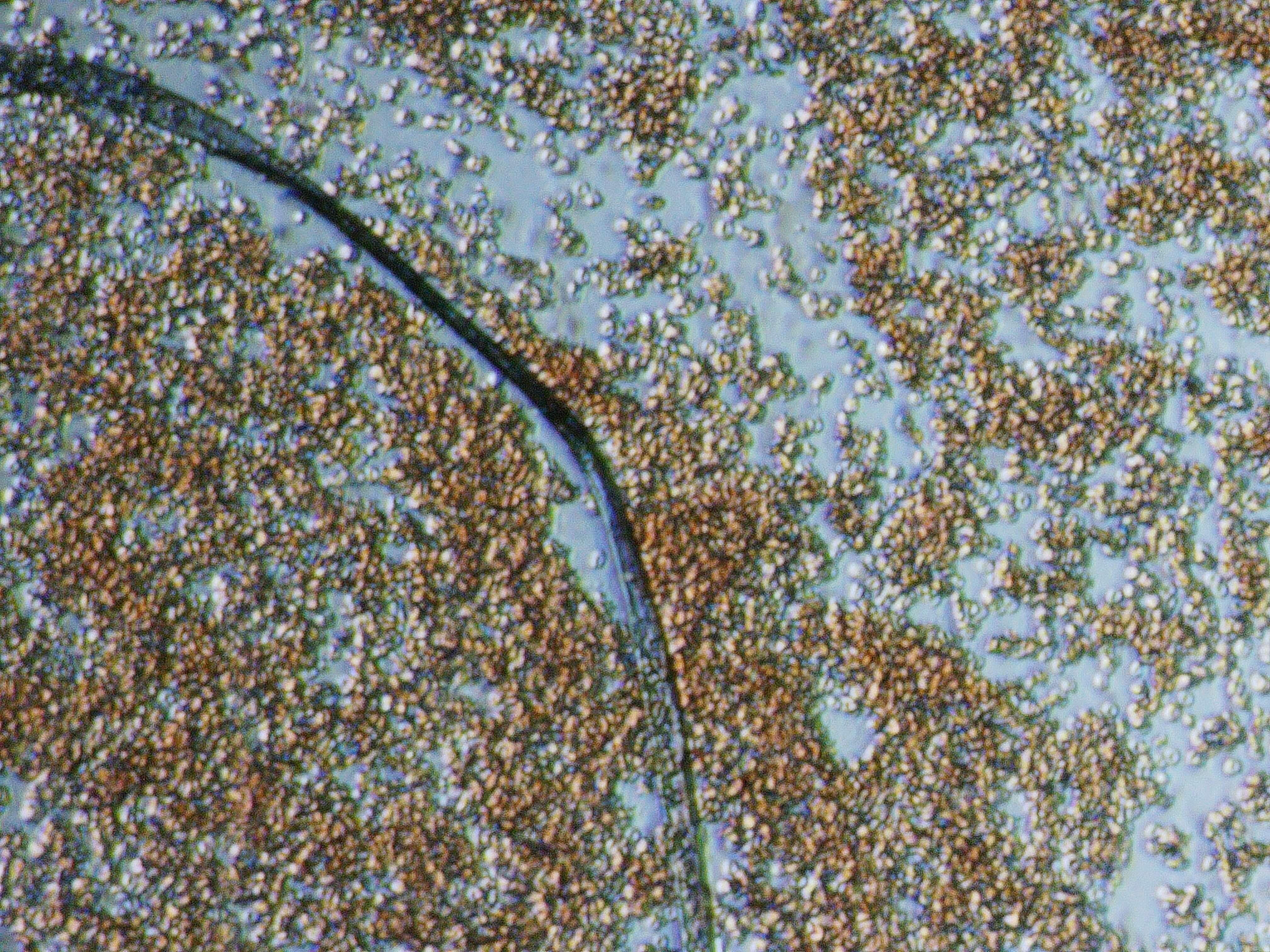 Morgellons Like Filament Tumor Found In Nasal Cavity With Insect ...