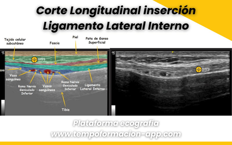 Anatomía y ecografía en rodilla - by Tempo Formación