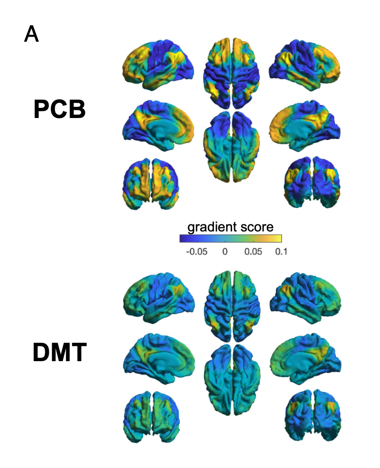 Your Brain on DMT... - by Andrew R. Gallimore