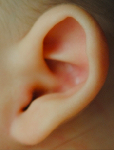 Pediatric Pearls: Infant's Ear - Pits, Tags, and the Pinna